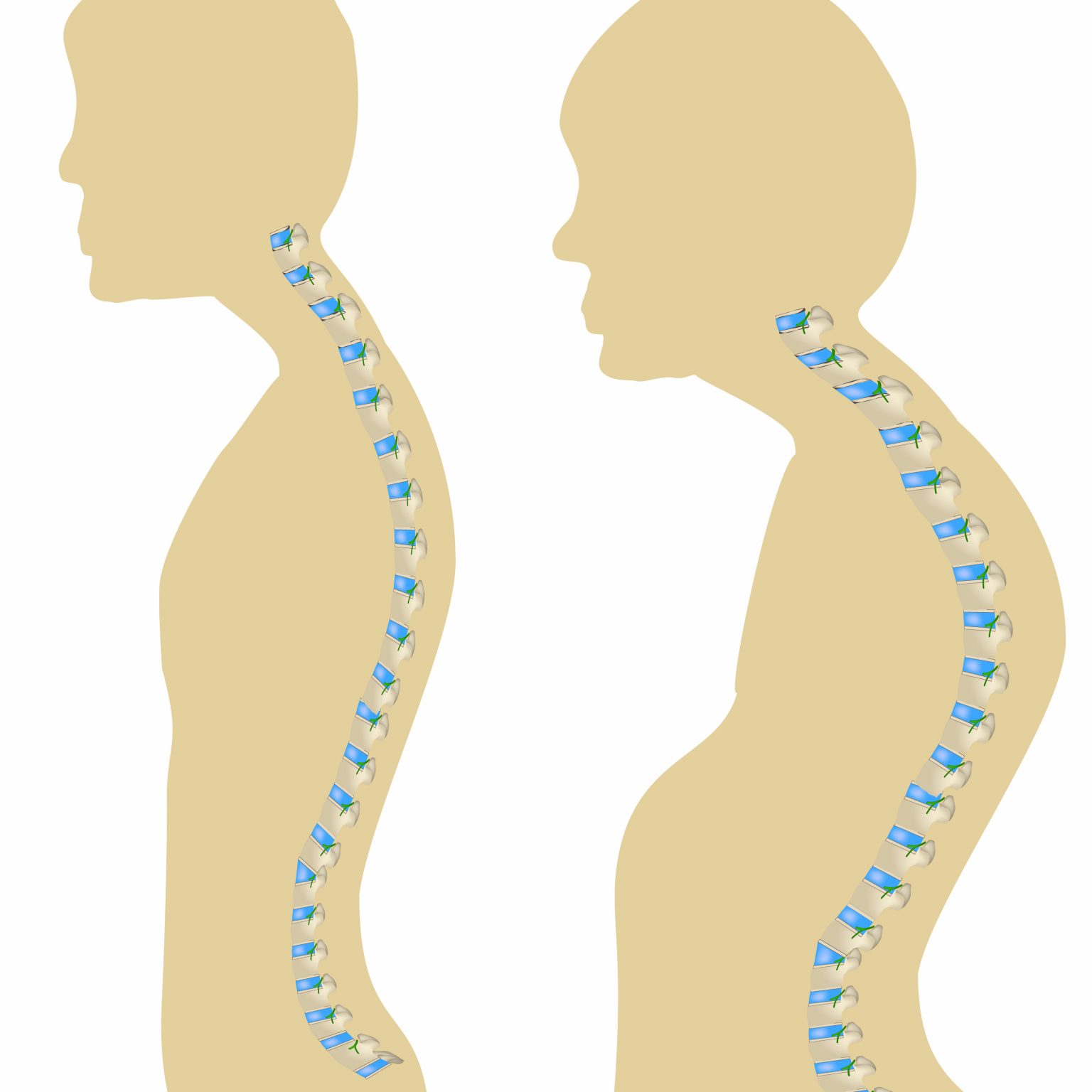 Posture Correction Toronto | Transform Chiropractic